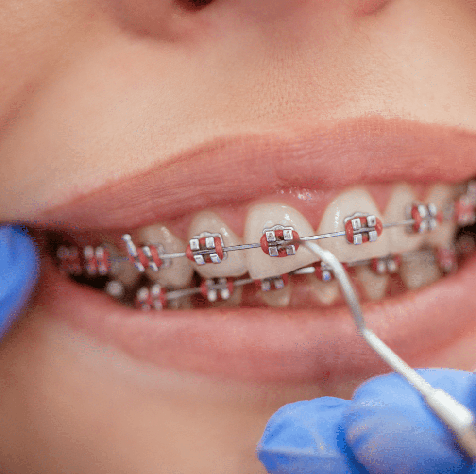 Family, Teen & Adult Orthodontics | Rivoli Orthodontics Rochester NY